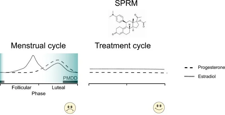 Treatment for PMDD: A Comprehensive Guide — PHASES clinic