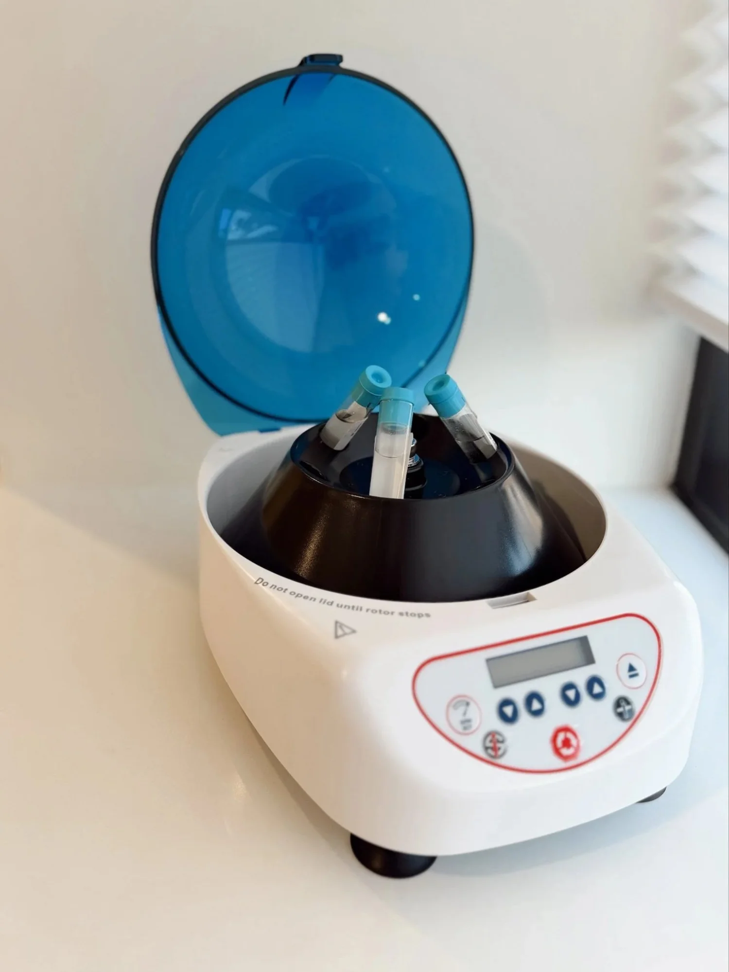 PRF Under Eye Treatment Green Bay, WI — Wagner Aesthetic Studio