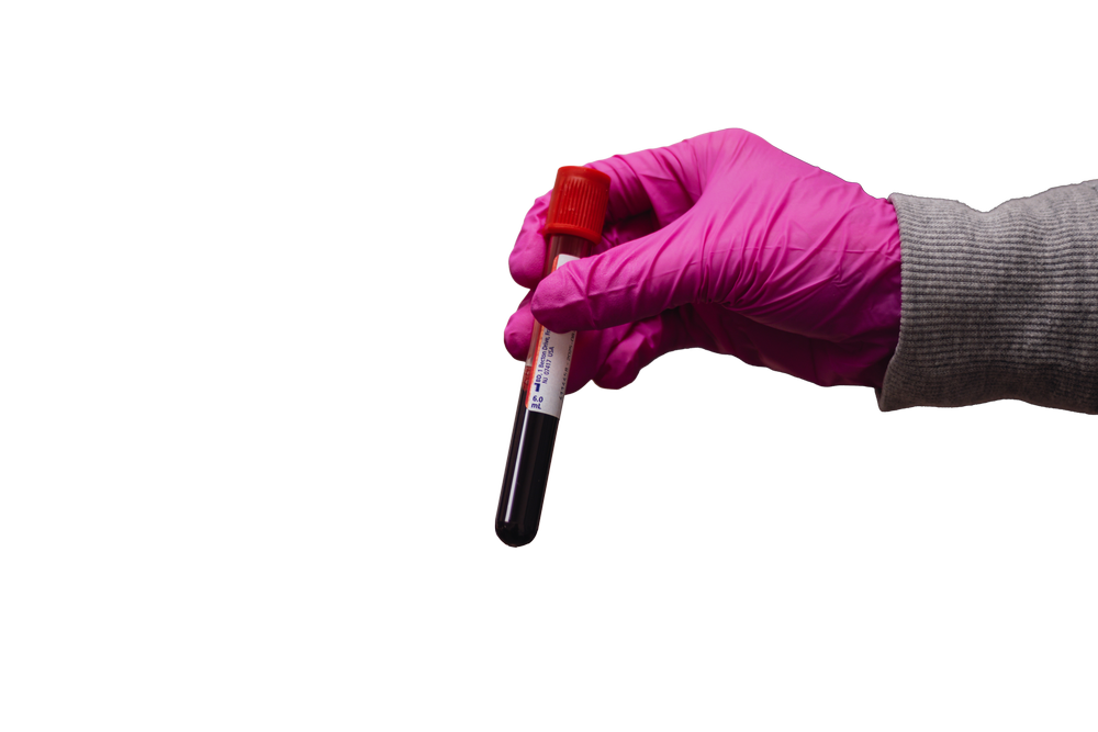 Gentle Touch Blood Collection | Schedule Your Test Today