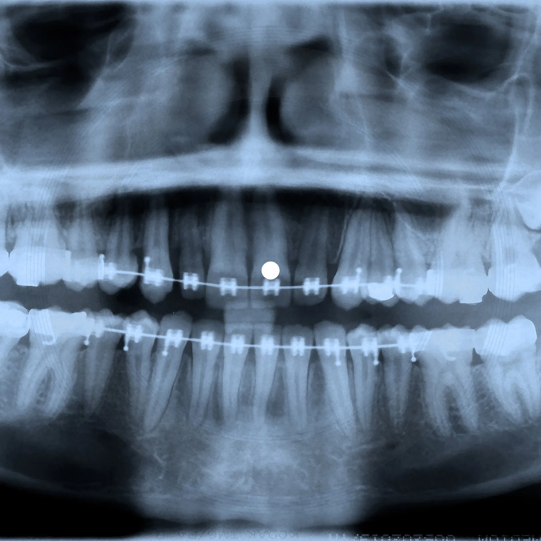 Bone Music Resurrection — Art Lantern