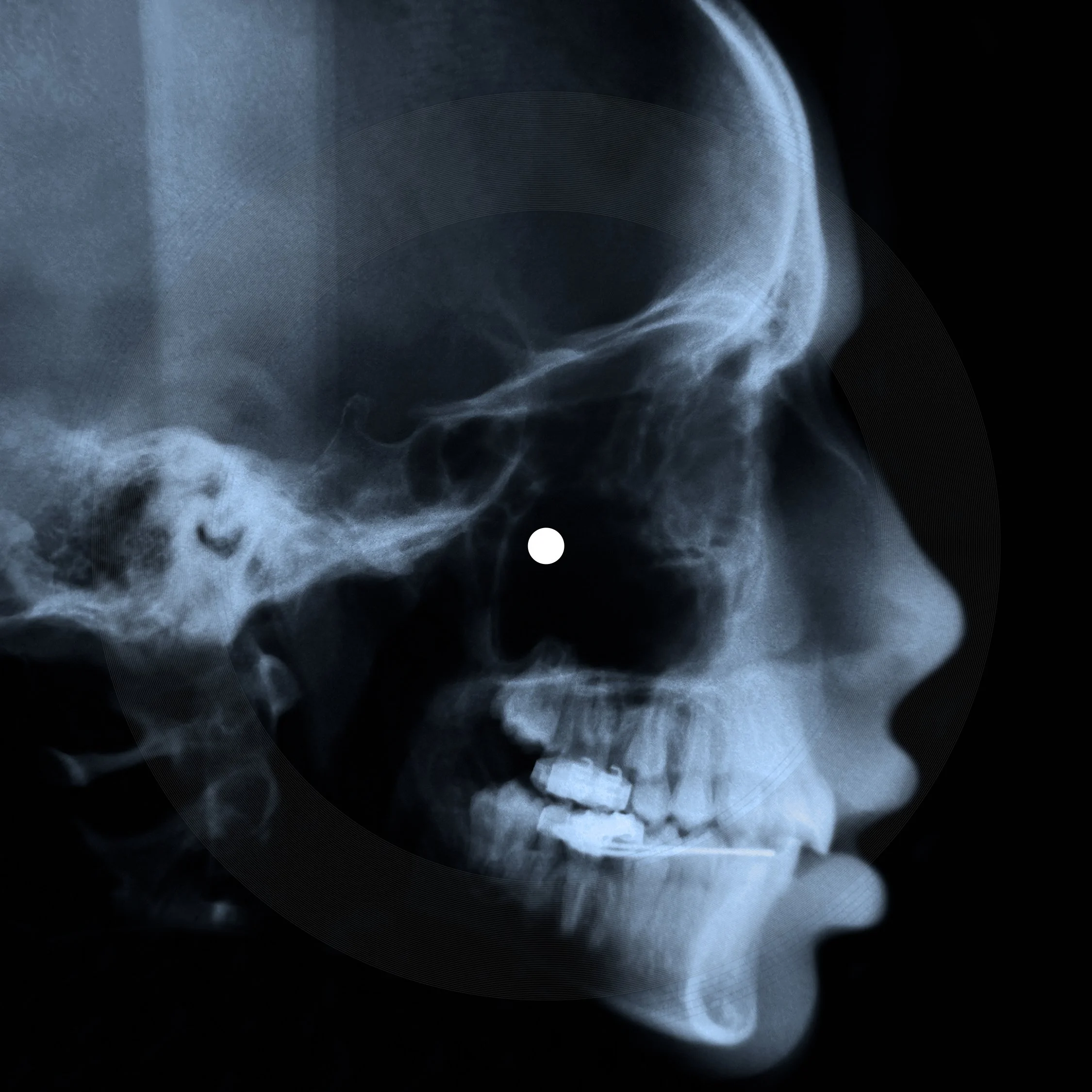 Bone Music Resurrection — Art Lantern