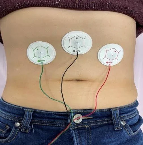 EndoSure - a rapid diagnostic tool for Endometriosis — Rapid Access ...