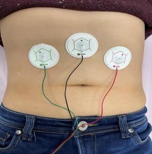 EndoSure - a rapid diagnostic tool for Endometriosis — Rapid Access ...